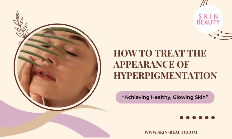 Treatment of Hyperpigmentation – Skin Beauty Blog
